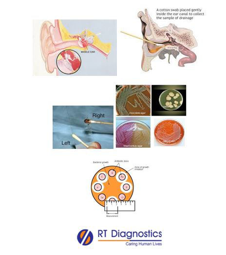 Culture Sensitivity Ear Swab RT Diagnostics